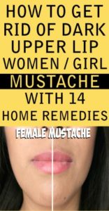 How to Get Rid of Dark Upper Lip Shadow or Female Mustache - Lighten ...