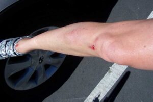 Red Spots on Skin: Easy Causes, Treatments, and Solutions - Skin ...